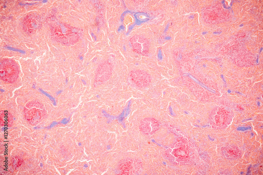 Showing Light micrograph of the Adrenal gland, Spleen human and Other ...