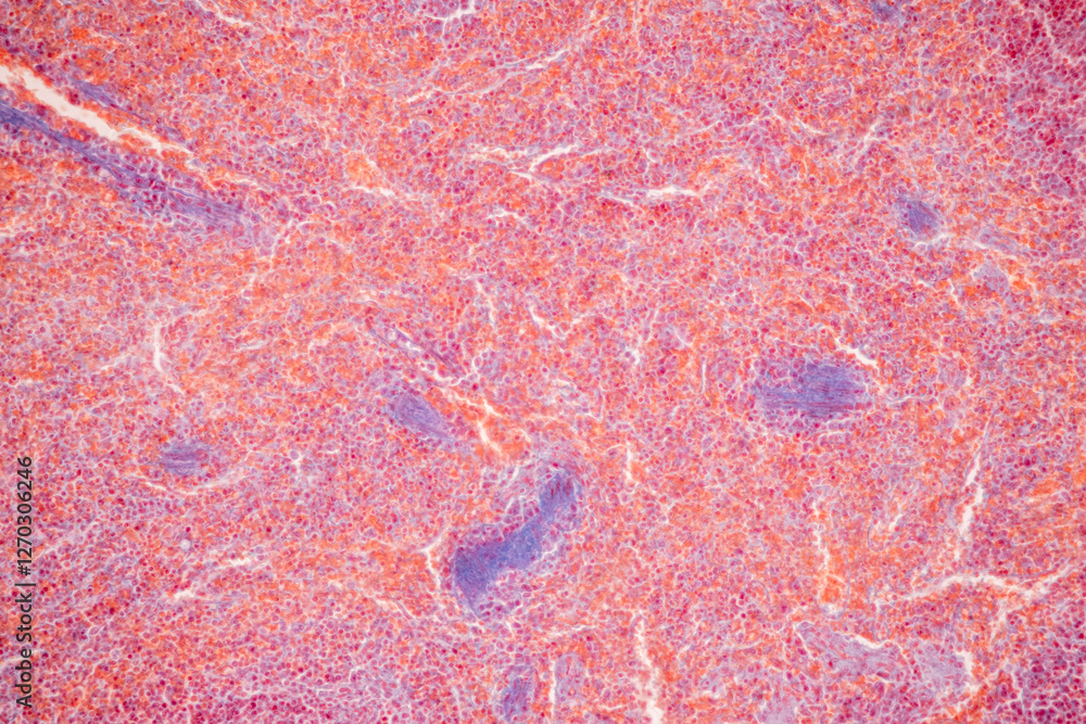 Showing Light micrograph of the Adrenal gland, Spleen human and Other ...