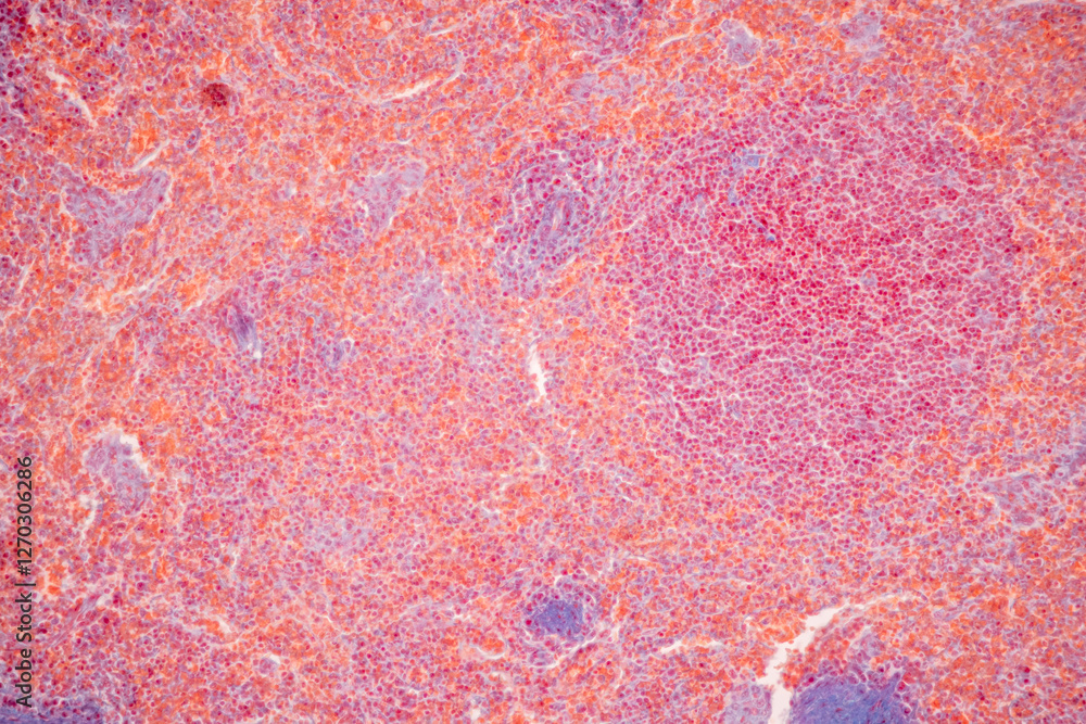 Showing Light micrograph of the Adrenal gland, Spleen human and Other ...