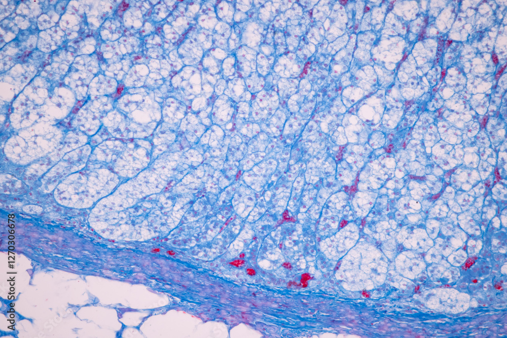 Photo Stock Showing Light micrograph of the Adrenal gland, Spleen human ...