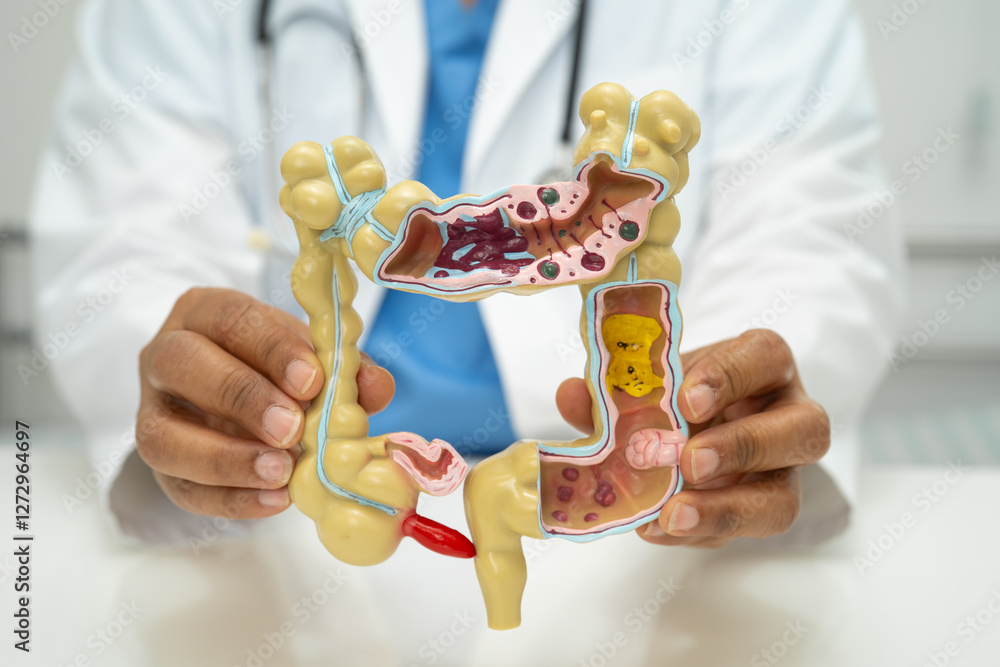 Intestine, appendix and digestive system, doctor holding anatomy model ...