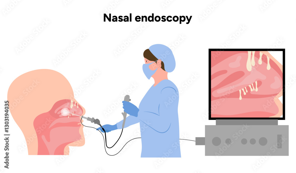 Nasal endoscopy procedure nasal and sinus passages. Thin, flexible tube ...