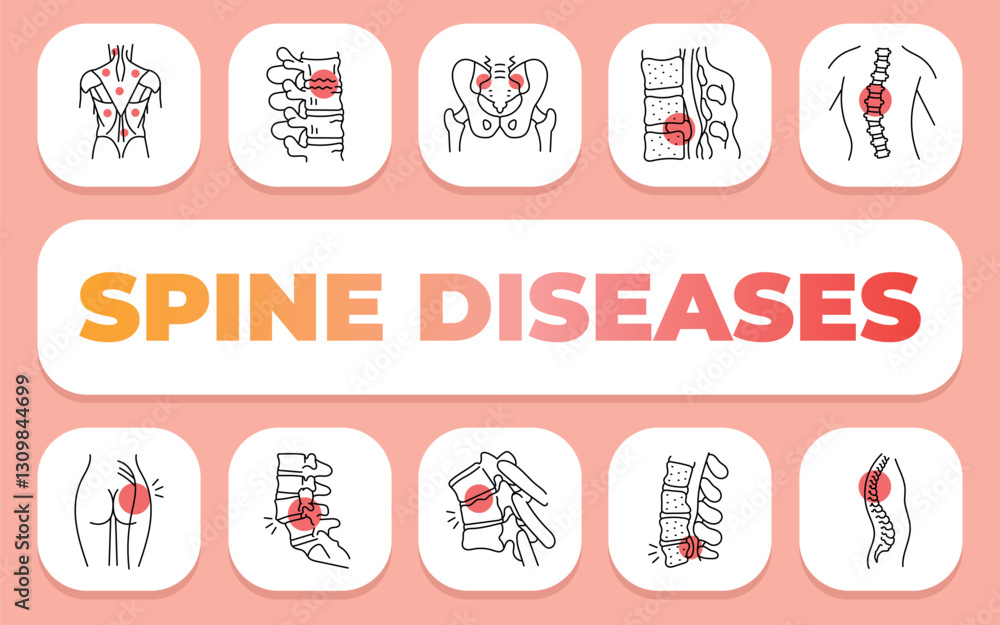 spine diseases text concept. Shablon for presentation and Infographics ...