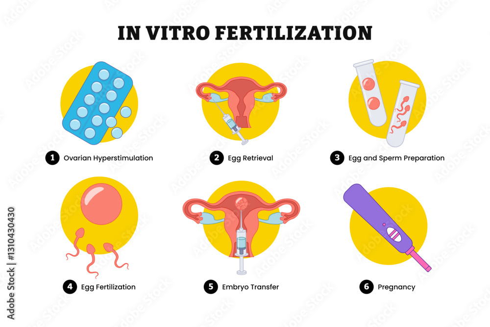 In Vitro Fertilization steps guide infographic poster design, medical ...