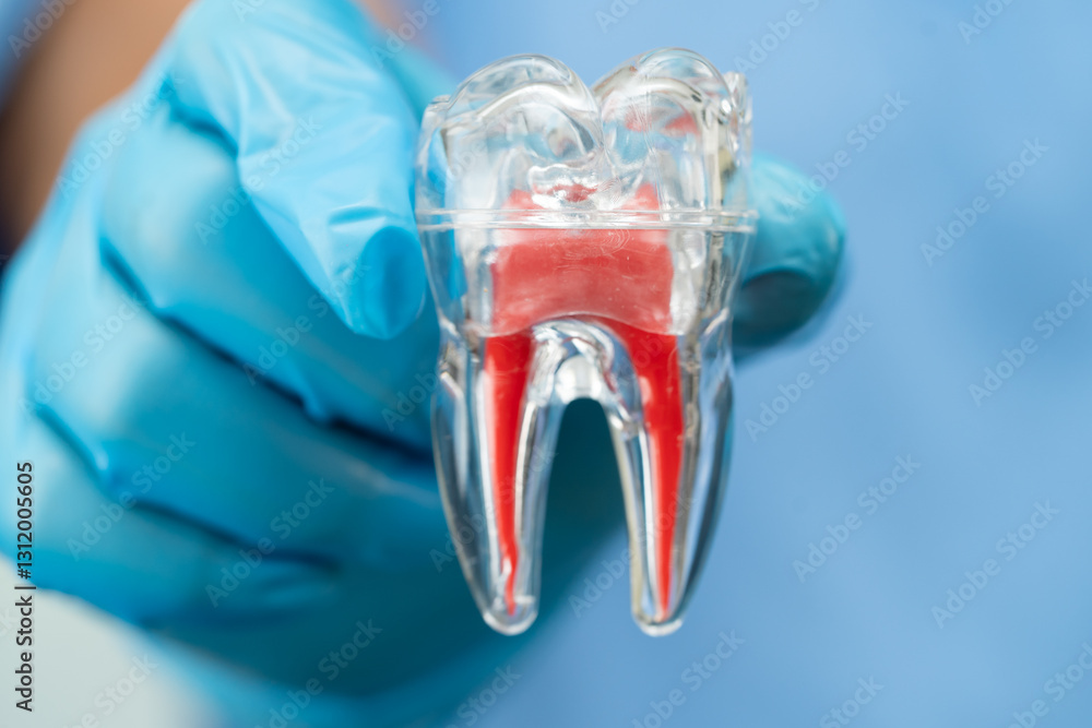Asian dentist holding dental implant, artificial tooth roots into jaw ...