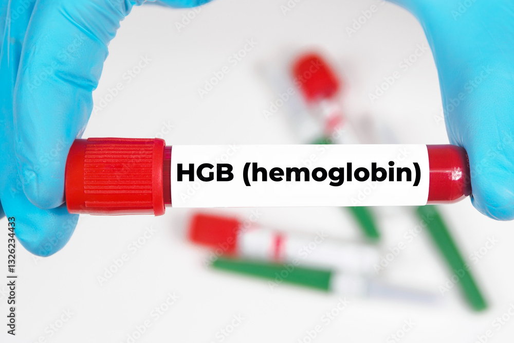 HGB (Hemoglobin) medical analysis value test tube background Stock ...