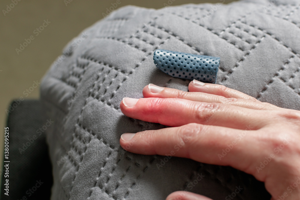 Mallet finger healing after splint removal from middle finger following ...