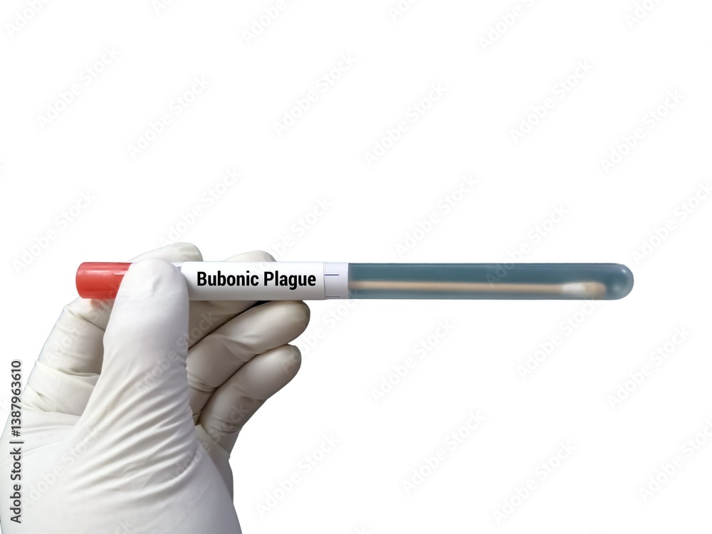 Blood sample for Bubonic plague test. It's one of three types of plague ...