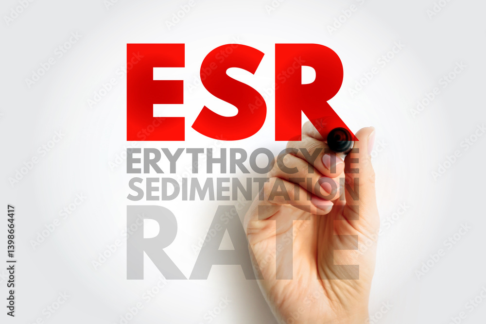 ESR Erythrocyte Sedimentation Rate - type of blood test that measures ...