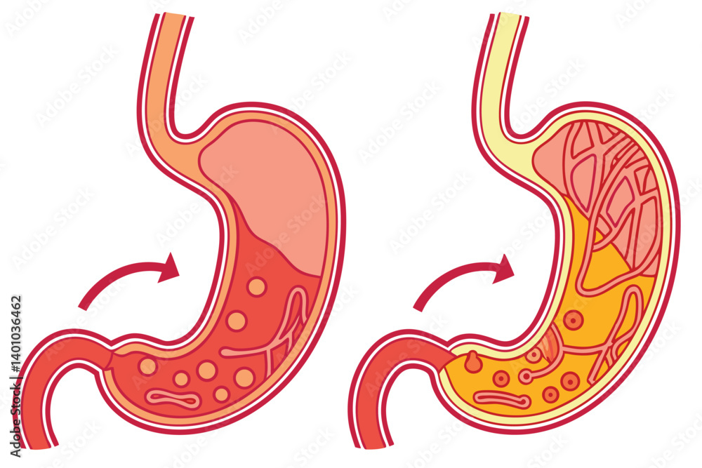 14 Medical illustration, stomach anatomy, cross-section, digestive ...