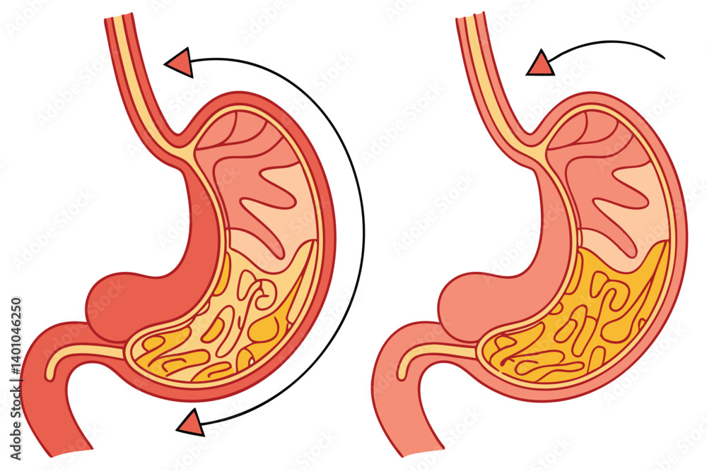 14 Medical illustration, stomach anatomy, cross-section, digestive system, gastric acid, stomach ...