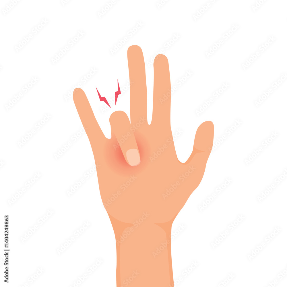 Trigger Finger with ring finger get stuck in a bent position caused by ...