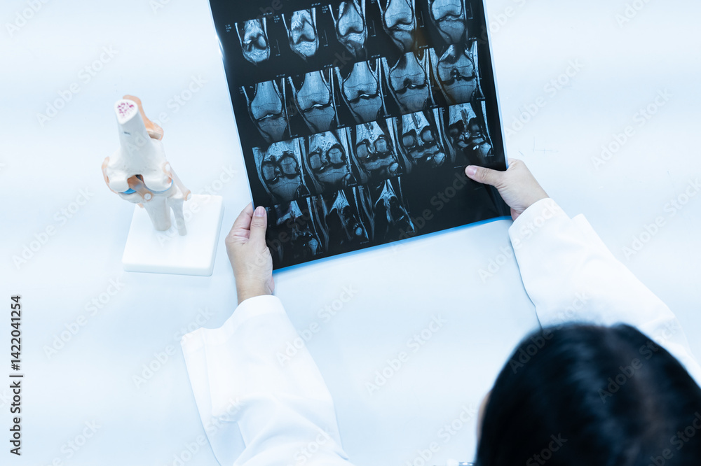 Doctor holding patient bone x-ray film before surgery.Image MRI and CT ...