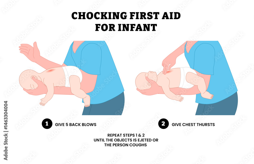 Baby chest rescue breath care safety for Choking first aid food CPR ...