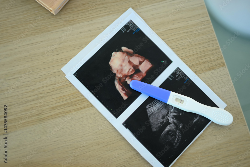 3D and 2D ultrasound pictures with a pregnancy test. Fetal development ...