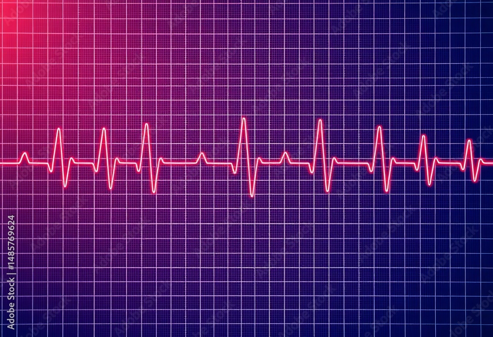 ECG showing normal sinus rhythm with pulse rate diagram, EKG, heart ...