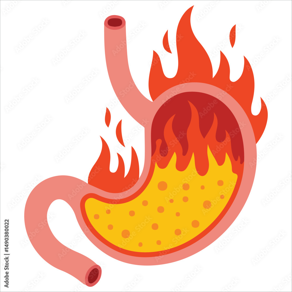 Burning stomach acid reflux isolated vector illustration on white ...