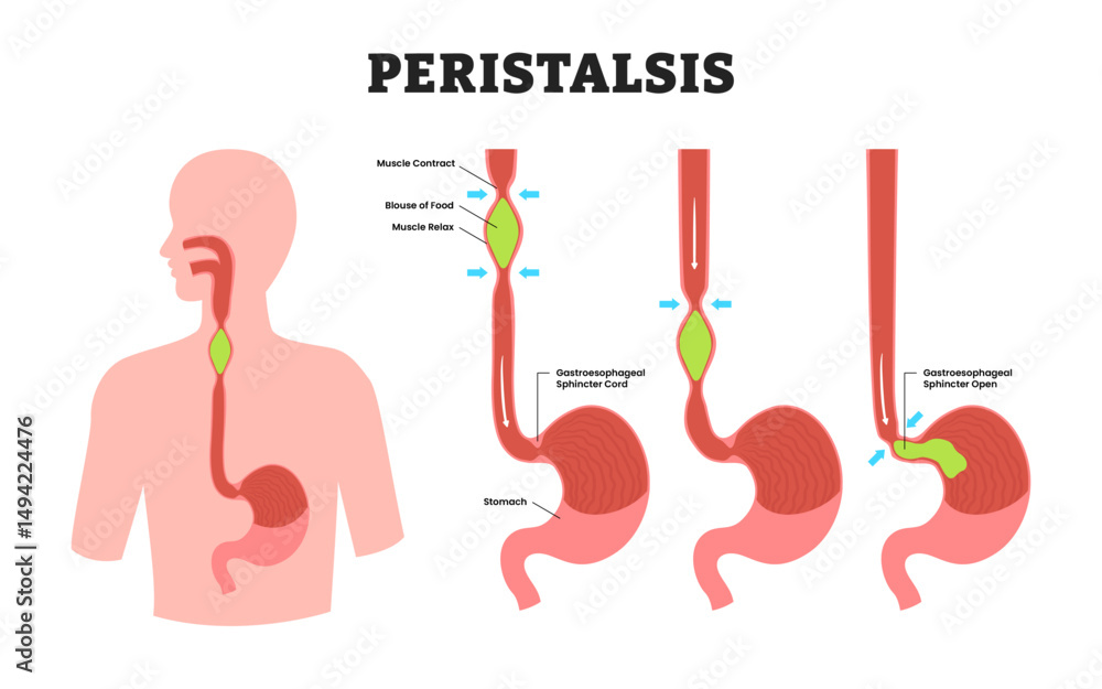 Peristalsis, educational medical poster design healthcare scheme, human ...