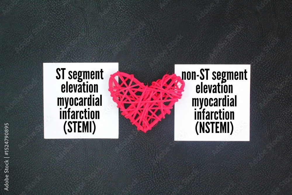Are there 2 types of heart attacks? ST-elevation myocardial infarction ...