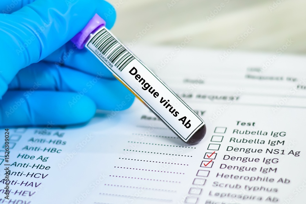 Stock-Foto „Blood sample tube and paper order request for dengue virus ...