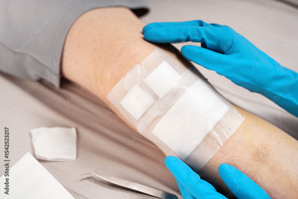 Medical professional hands in gloves change bandage on a patient ...