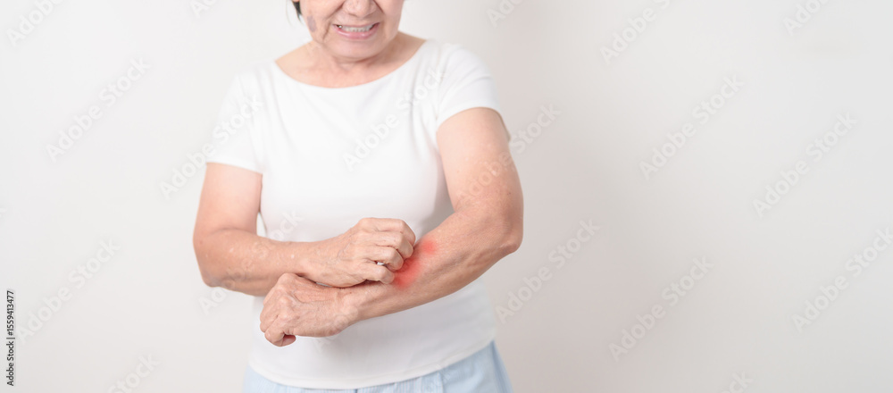 Elderly woman itching arm and body scratching for Skin Allergy from ...