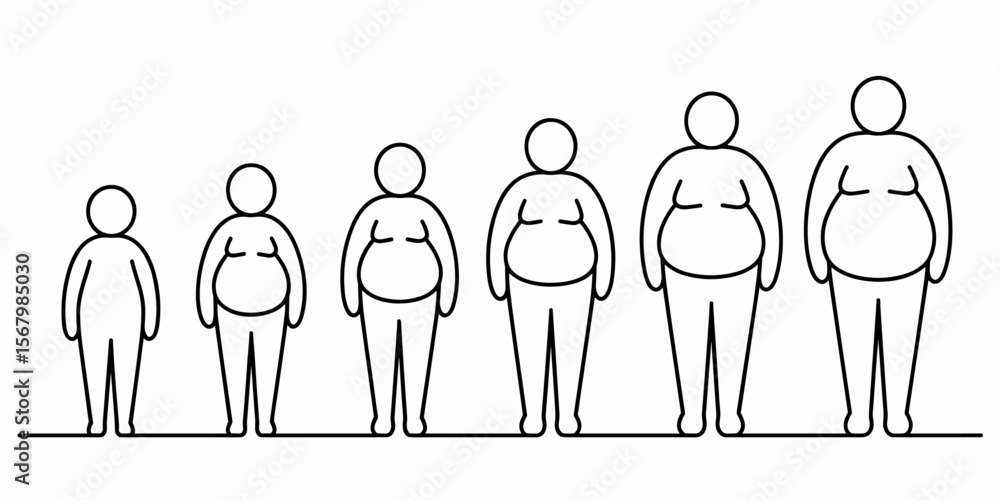 Body Mass Index stages, overweight progression, obesity, stages of ...