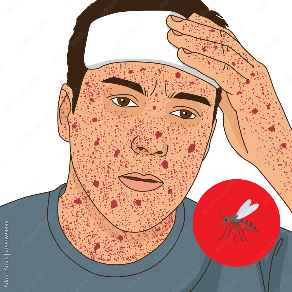 A man with dengue fever puts a fever-reducing patch on his forehead ...