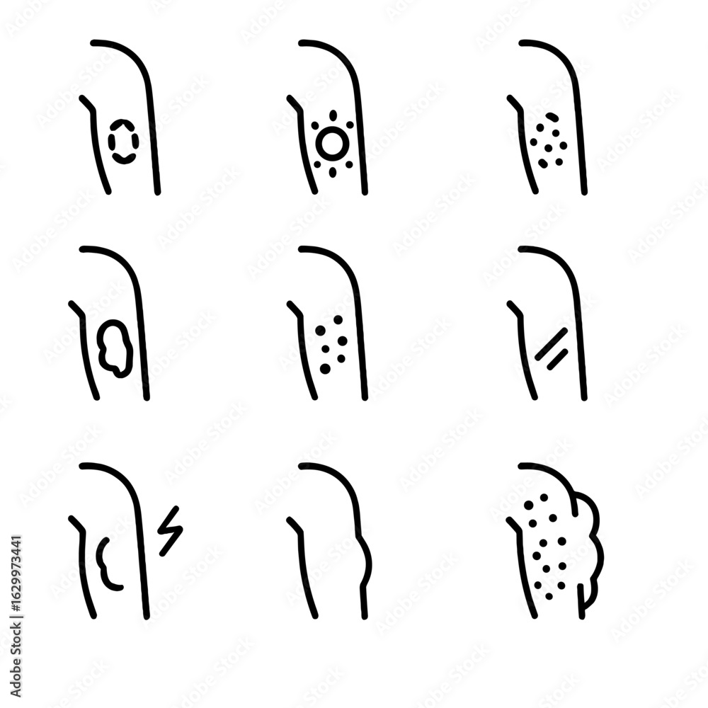 Bruise Severity Icons. Outline icon set of bruising severity: mild ...