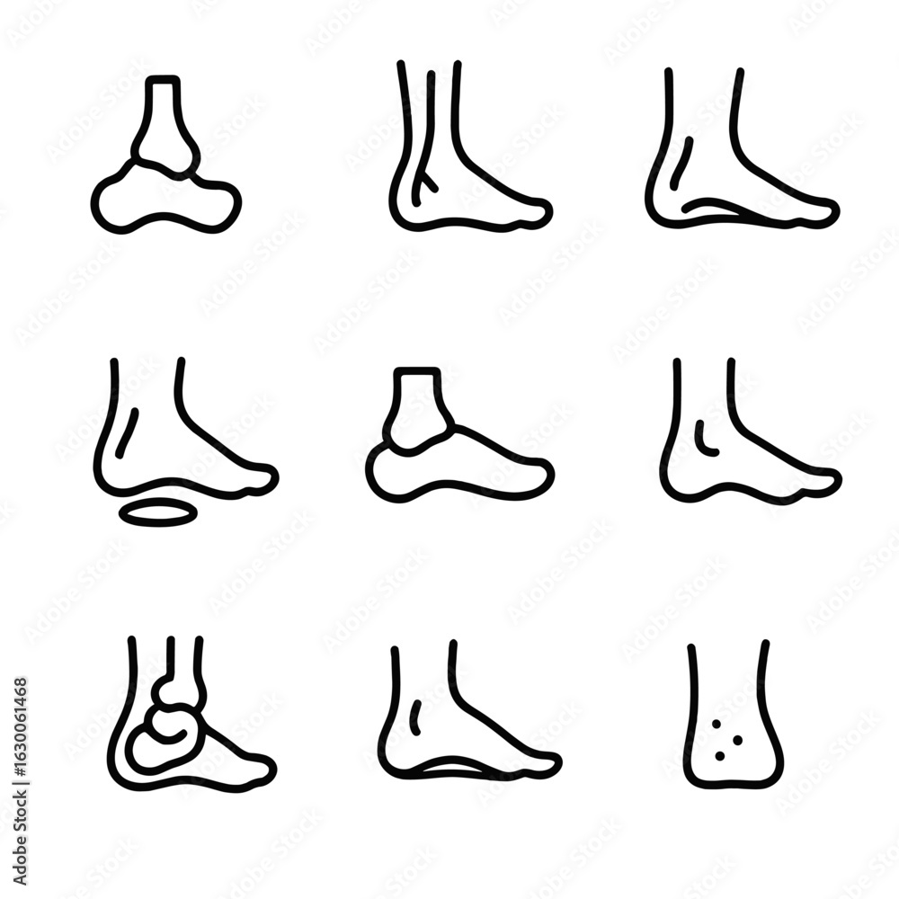 Heel Anatomy Icons. Outline icon set of heel anatomy: heel bone ...