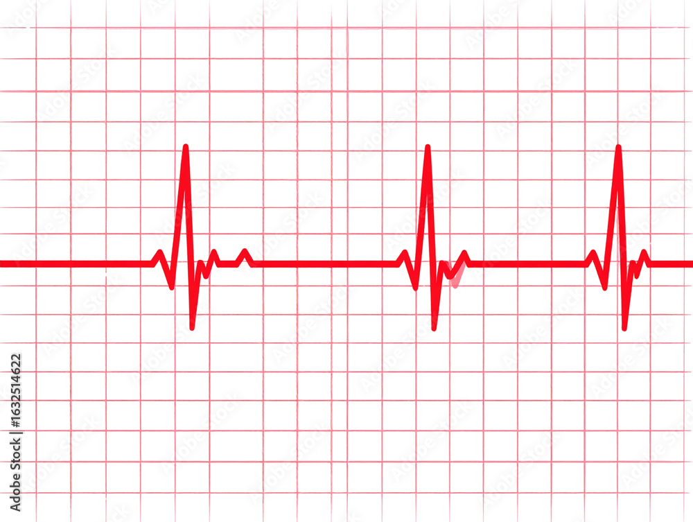 Illustration Stock Flat ECG Tracing of Regular Sinus Rhythm on Faint ...