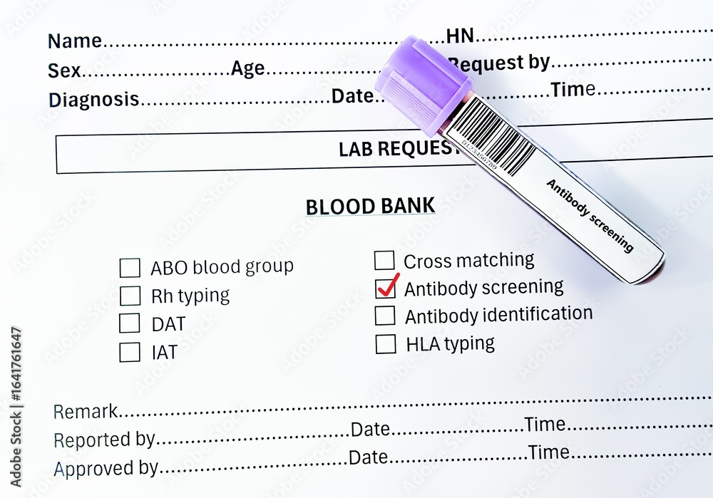 Blood sample tube and paper order request for antibody screening test ...