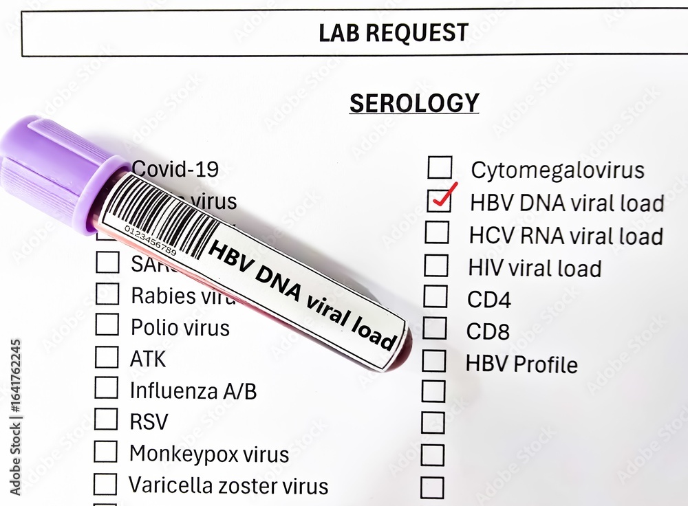 Blood sample tube and paper order request for HBV DNA viral load. Stock ...