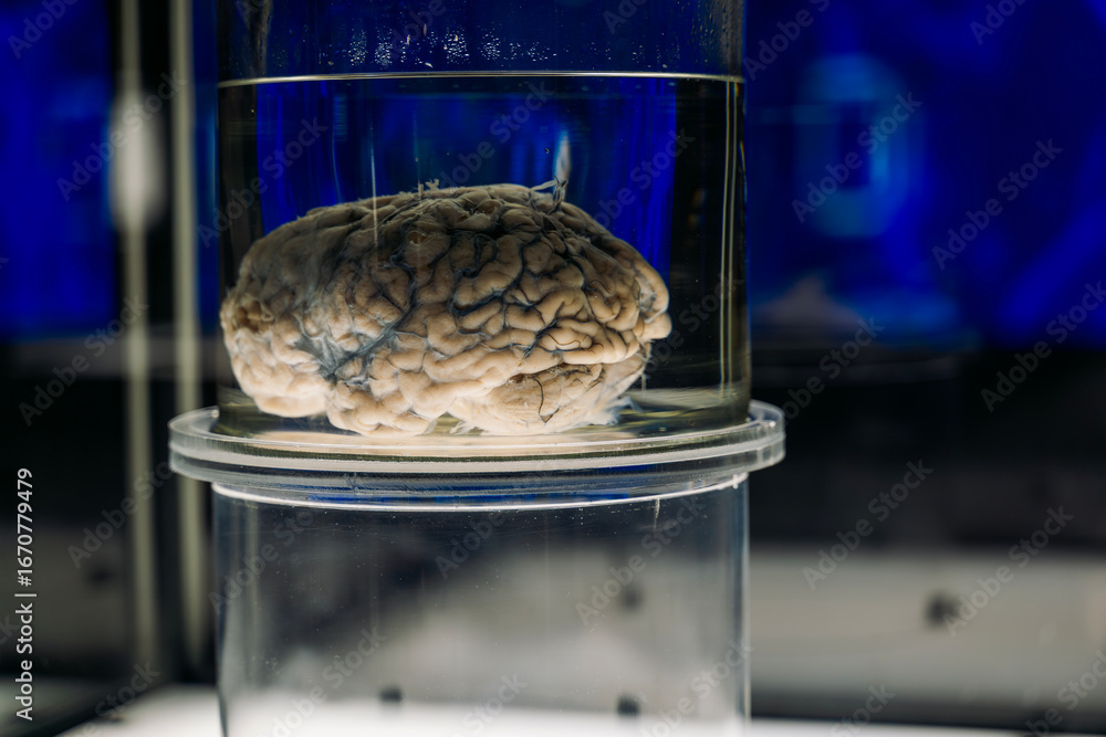 Photo Stock Human Brain Preserved in Glass Container | Adobe Stock
