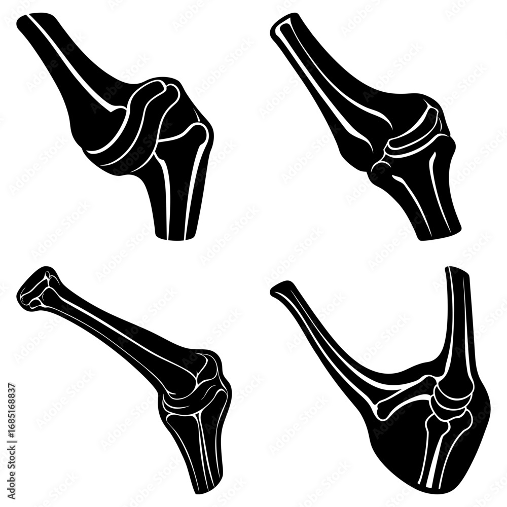 Four black and white illustrations of knee joints in different ...