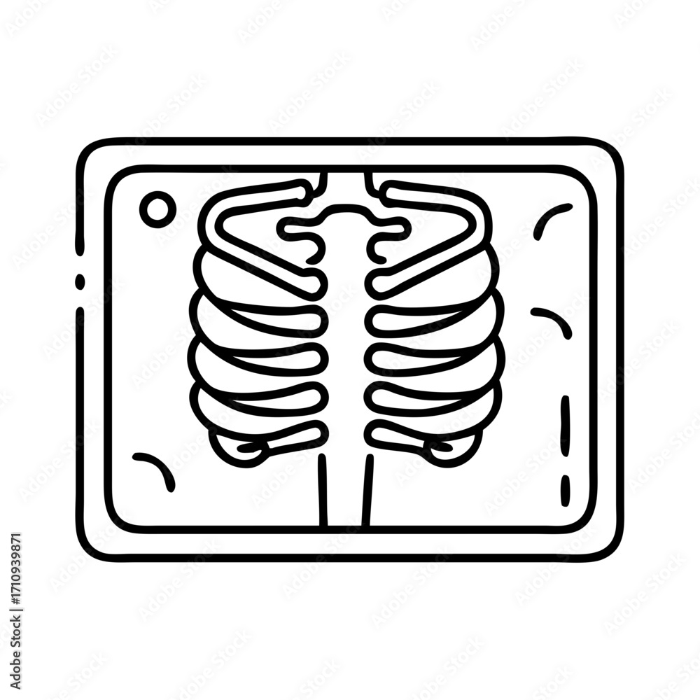 Vector art of chest xray medical imaging of the ribcage and lungs for ...