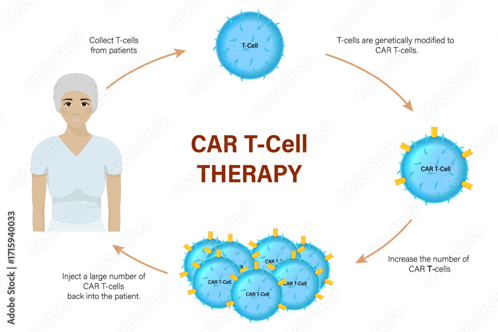 CAR T-cell therapy. Cancer immunotherapy. Immunotherapy. Engineering ...