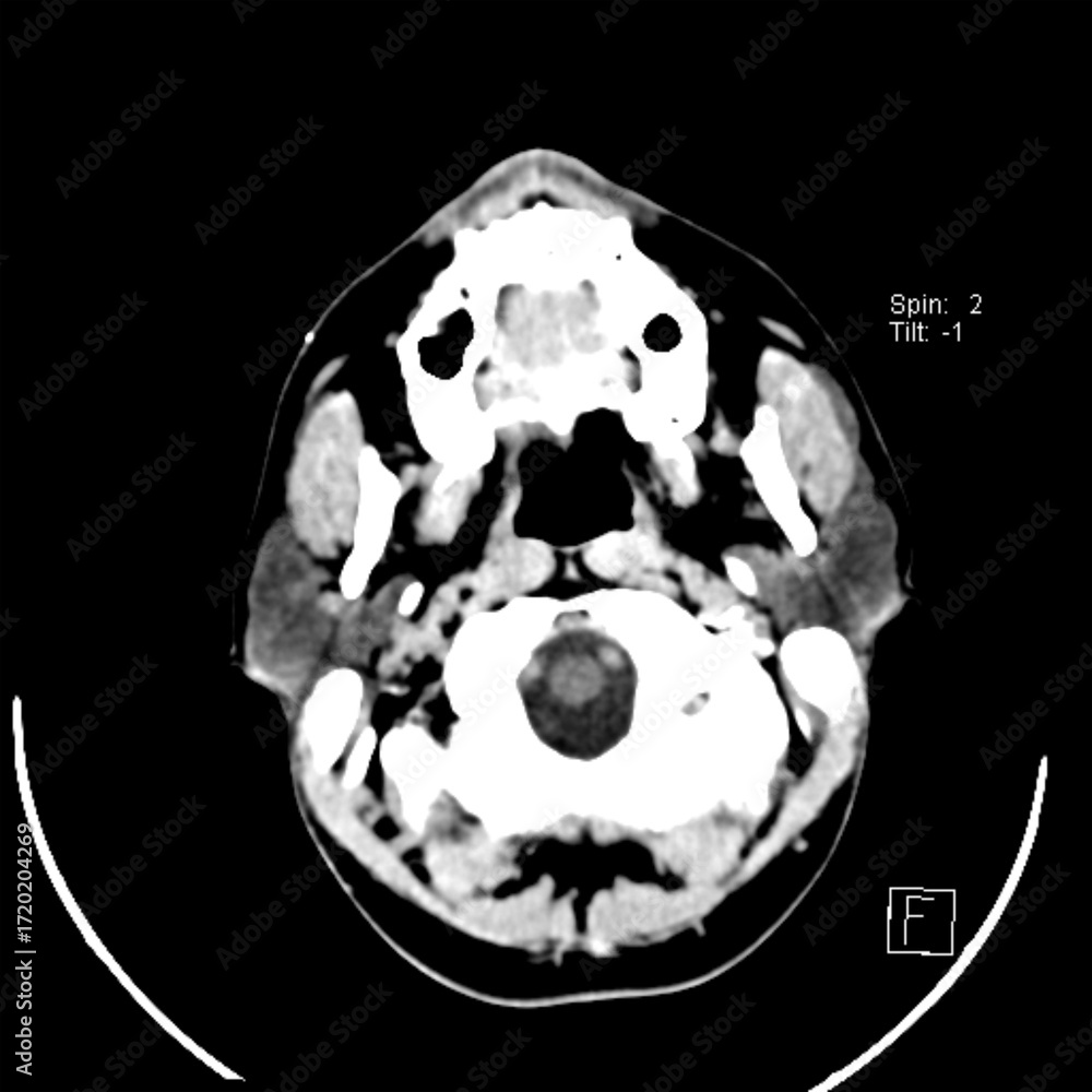 Medical CT Scan and X-Ray Imaging of Human Skull and Head Anatomy Stock ...