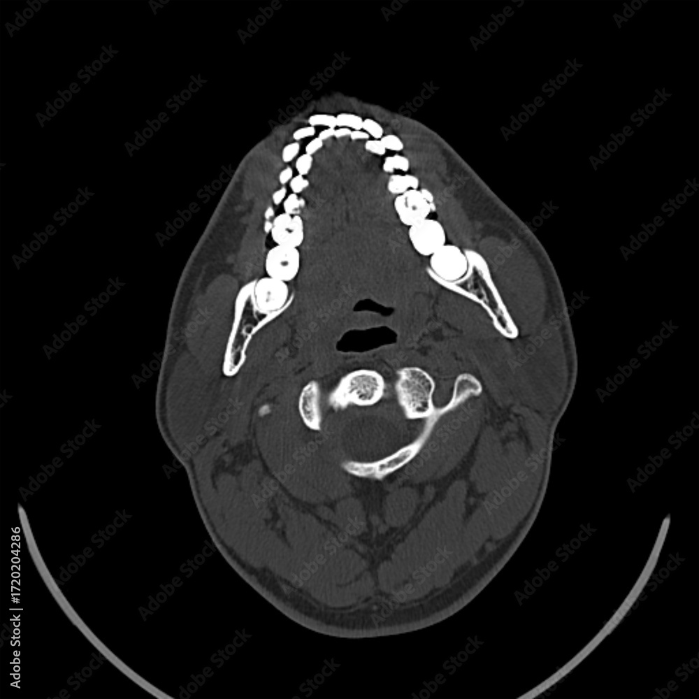 Medical CT Scan and X-Ray Imaging of Human Skull and Head Anatomy Stock ...