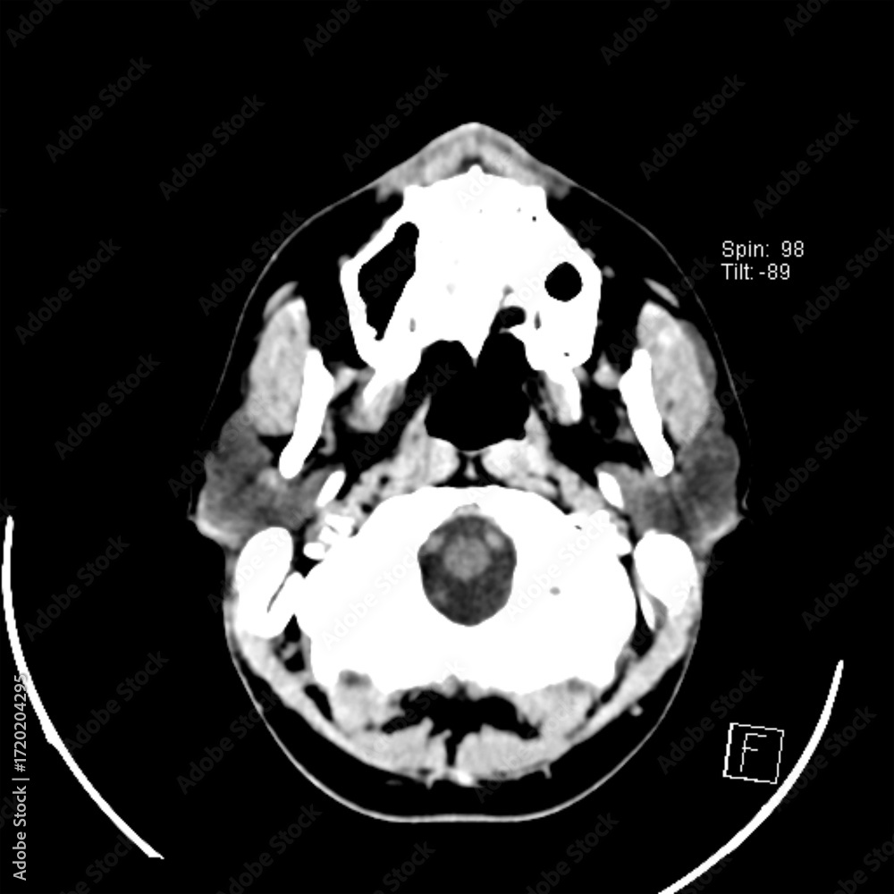 Medical CT Scan and X-Ray Imaging of Human Skull and Head Anatomy Stock ...