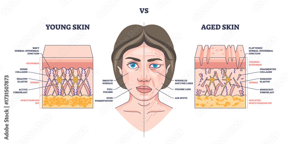 Vector de Stock Young vs aged skin shows differences in collagen ...