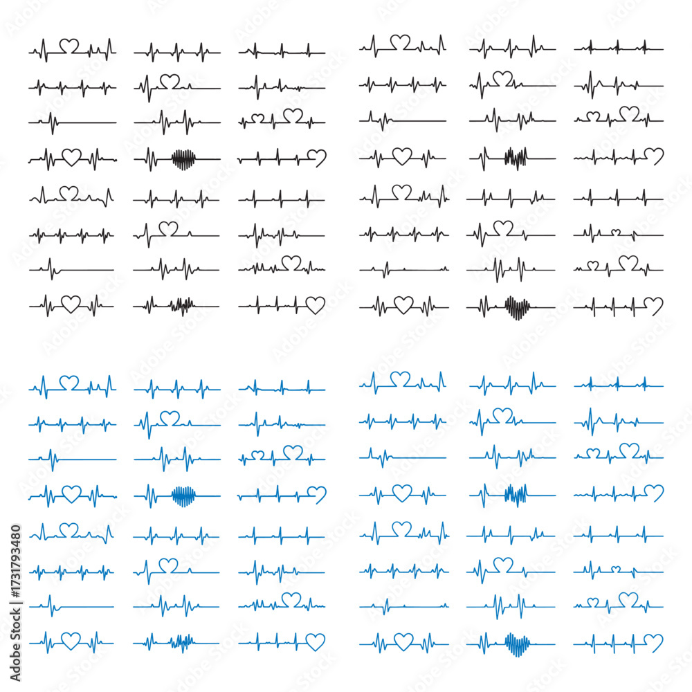 Heartbeat Line Vector Set – ECG, EKG, Heart Rate Monitor, Medical Pulse ...