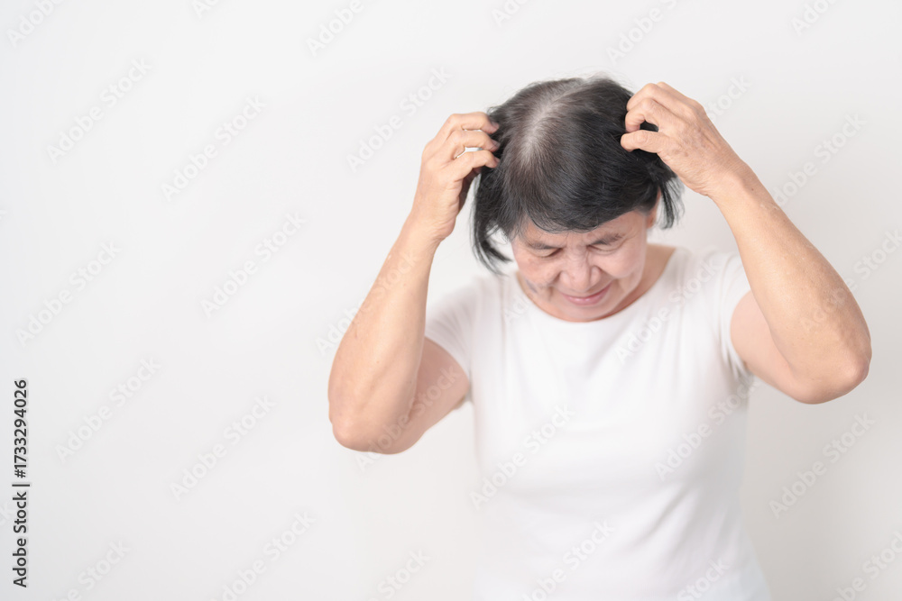 Elderly woman having itchy Scalp and Head hair, Dandruff, Dry Scalp ...