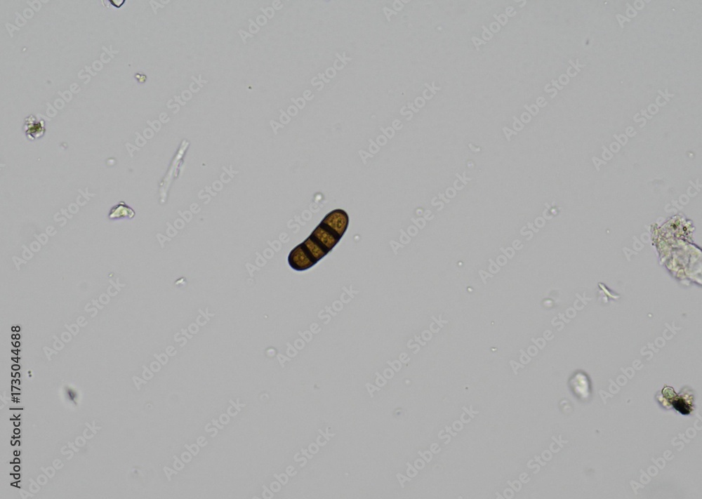 Photo Stock soil microorganisms under a microscope including amoeba ...