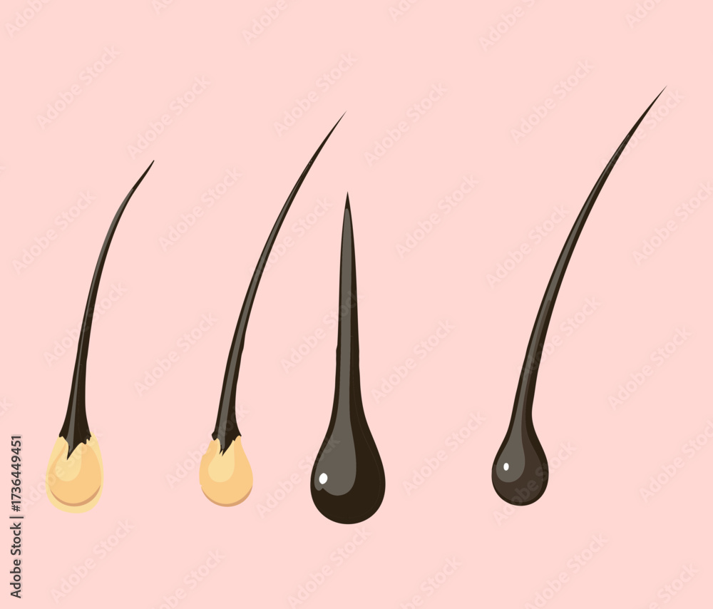 Vector de Stock Minimalist Diagram Showing Different Stages of Hair ...