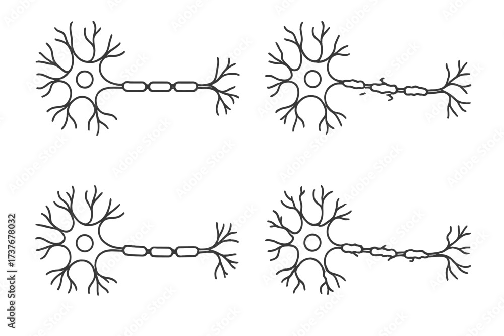 Comparison of healthy and damaged human neuron cells with intact and ...