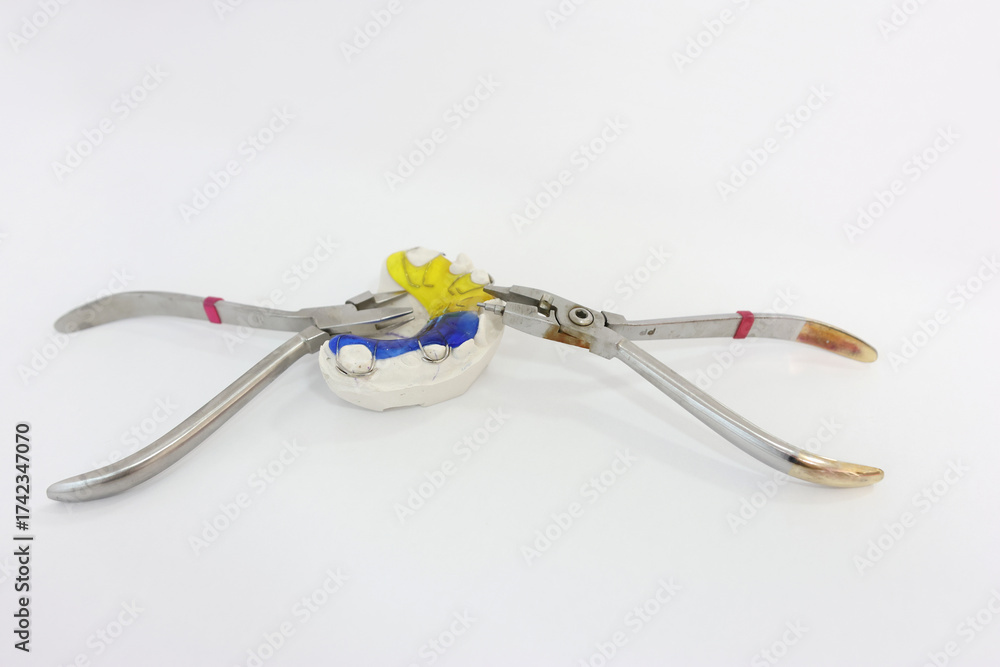 Mandibular teeth cast. Obtaining a cast of the dental arch for the ...