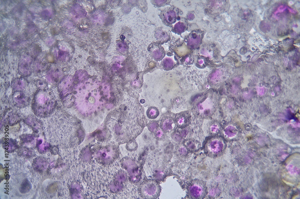 Light microscope analysis of AFB-stained sputum smear showing ...