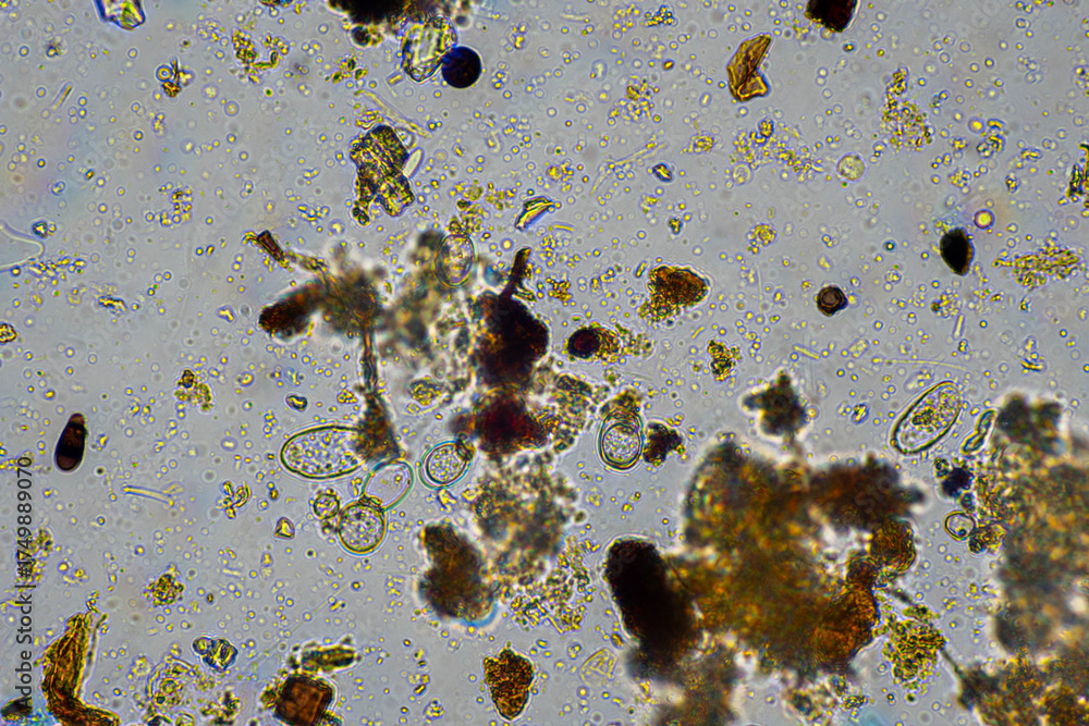 Photo Stock tardigrade soil microorganisms including nematode, and ...