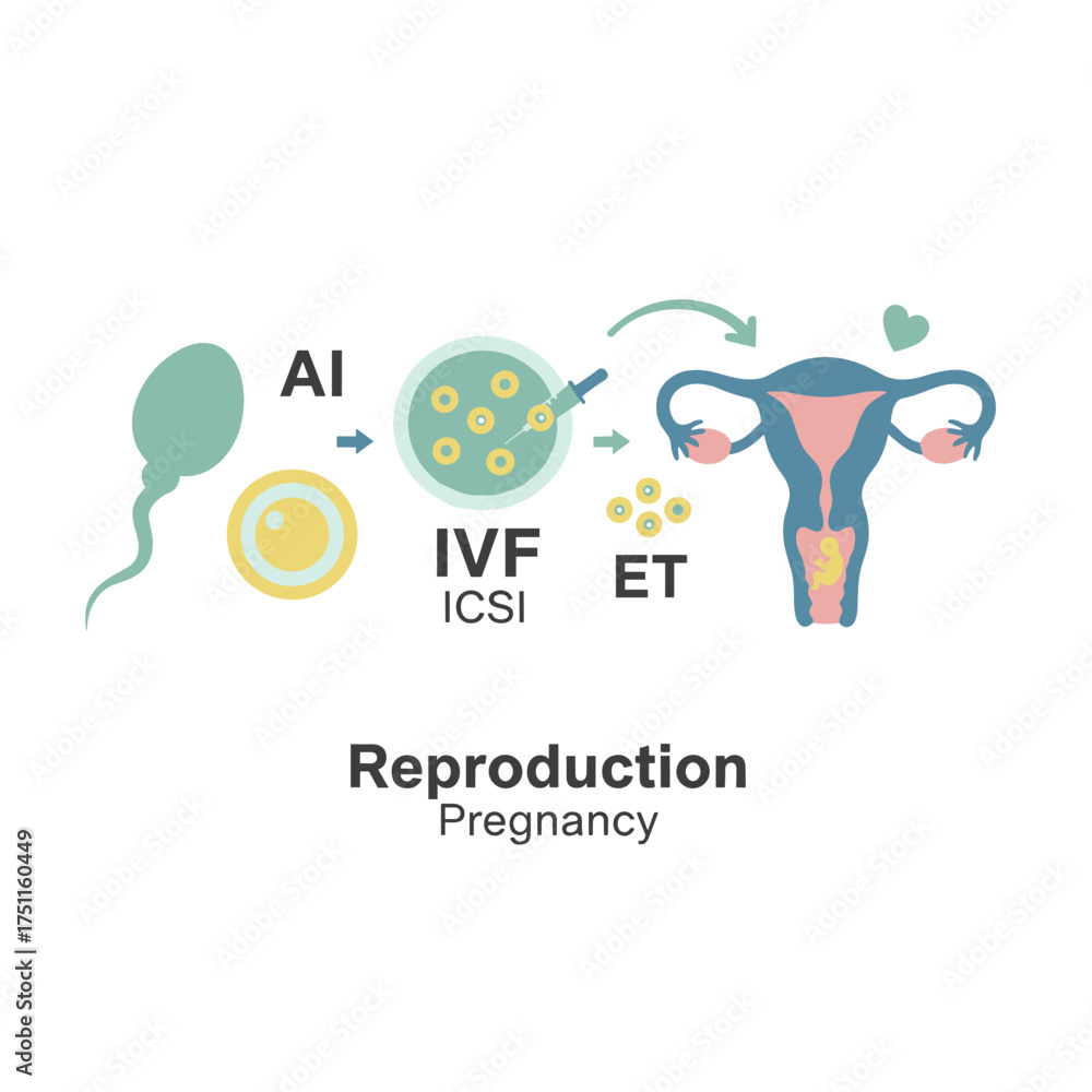 Stock-Vektorgrafik „Artificial insemination, in vitro fertilization ...